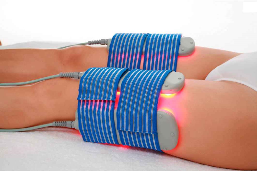 liposuccion au laser - Blog Univers-med liposuccion au laser - Blog Univers-med