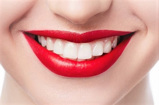 hollywood smile stars - Blog Univers-med