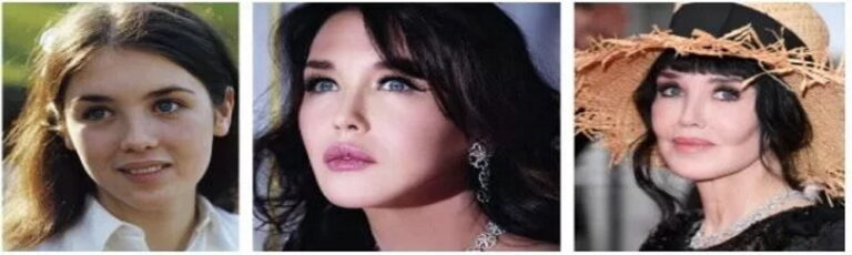 Isabelle Adjani chirurgie esthétique : visage , avant après