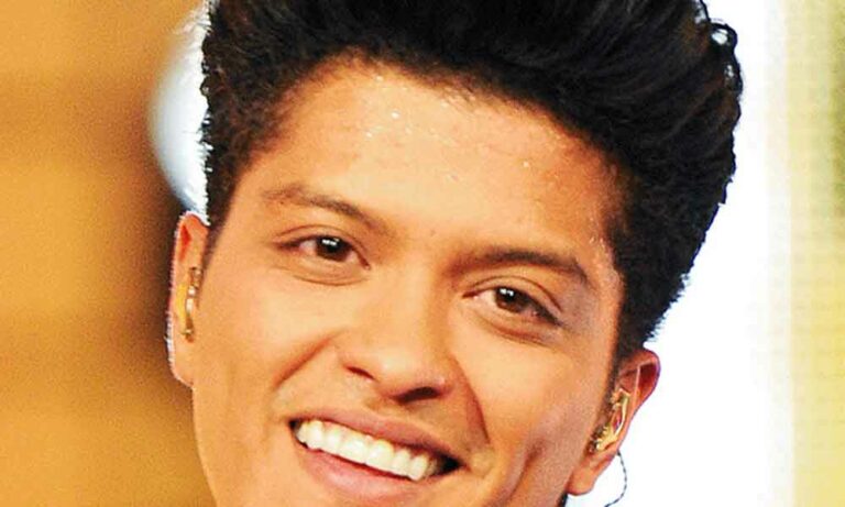 bruno mars dents avant chirurgie et apres photos